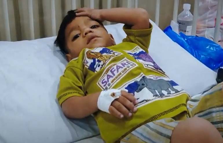 Colostomy Reversal Surgery Of Ali Ahmad Was Successful